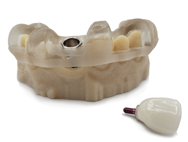 RealGUIDE™ Z3D Guided Surgery Kit voor TSX, TSV en Eztetic - Implacom BV